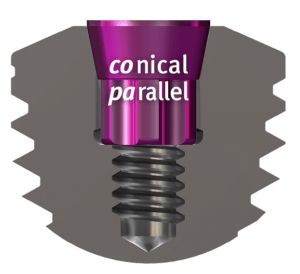 copaSKY - The conical parallel implant