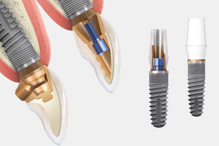 blueSKY - The bone level implant - bredent-implants