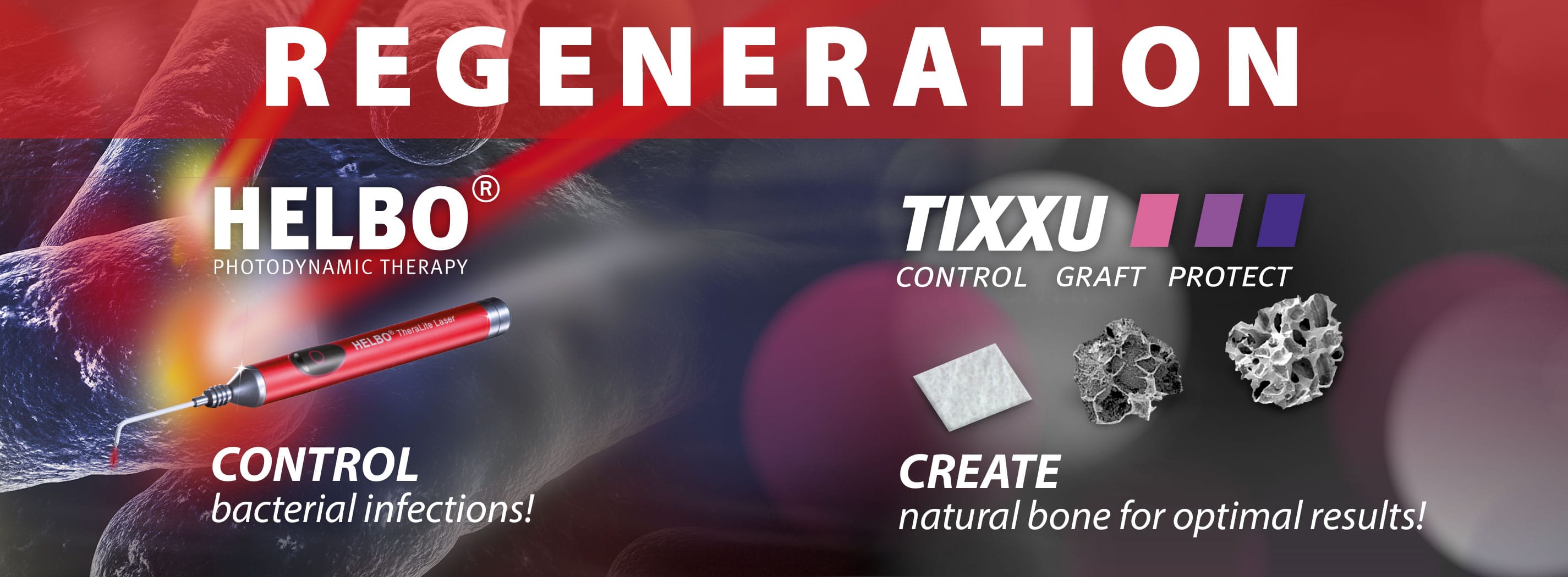 Home | bredent-implants