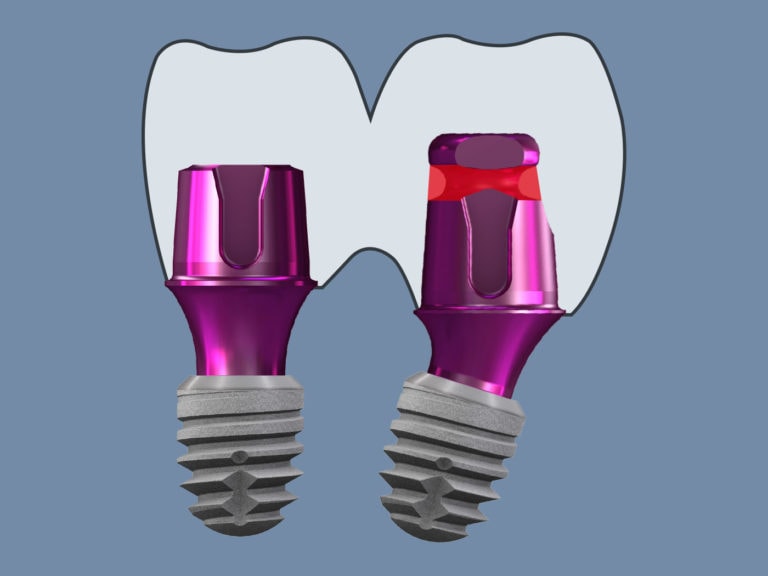 bredent group - Dental Innovations since 1974