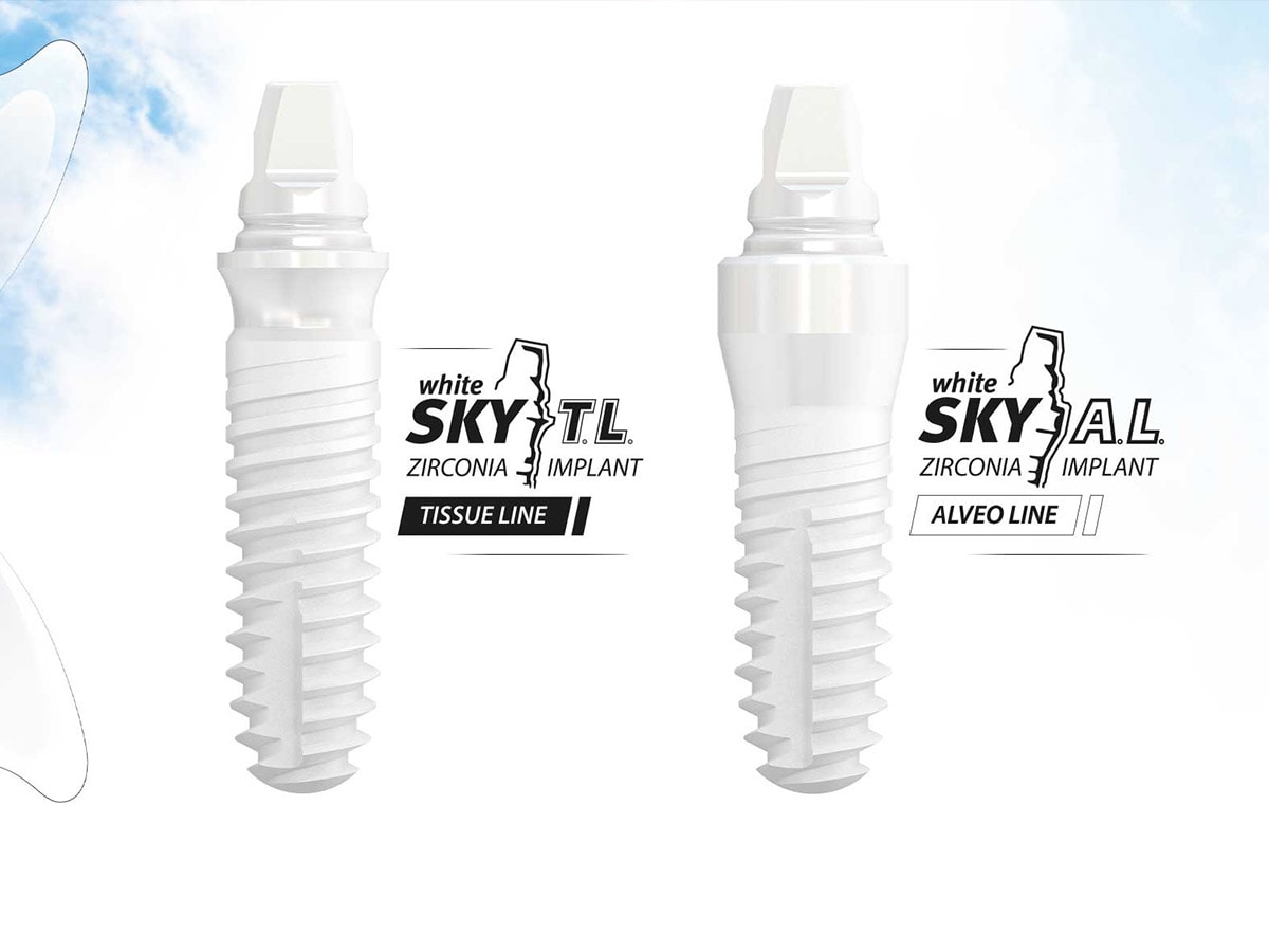 SKY Implant system - Leading in immediate restorations
