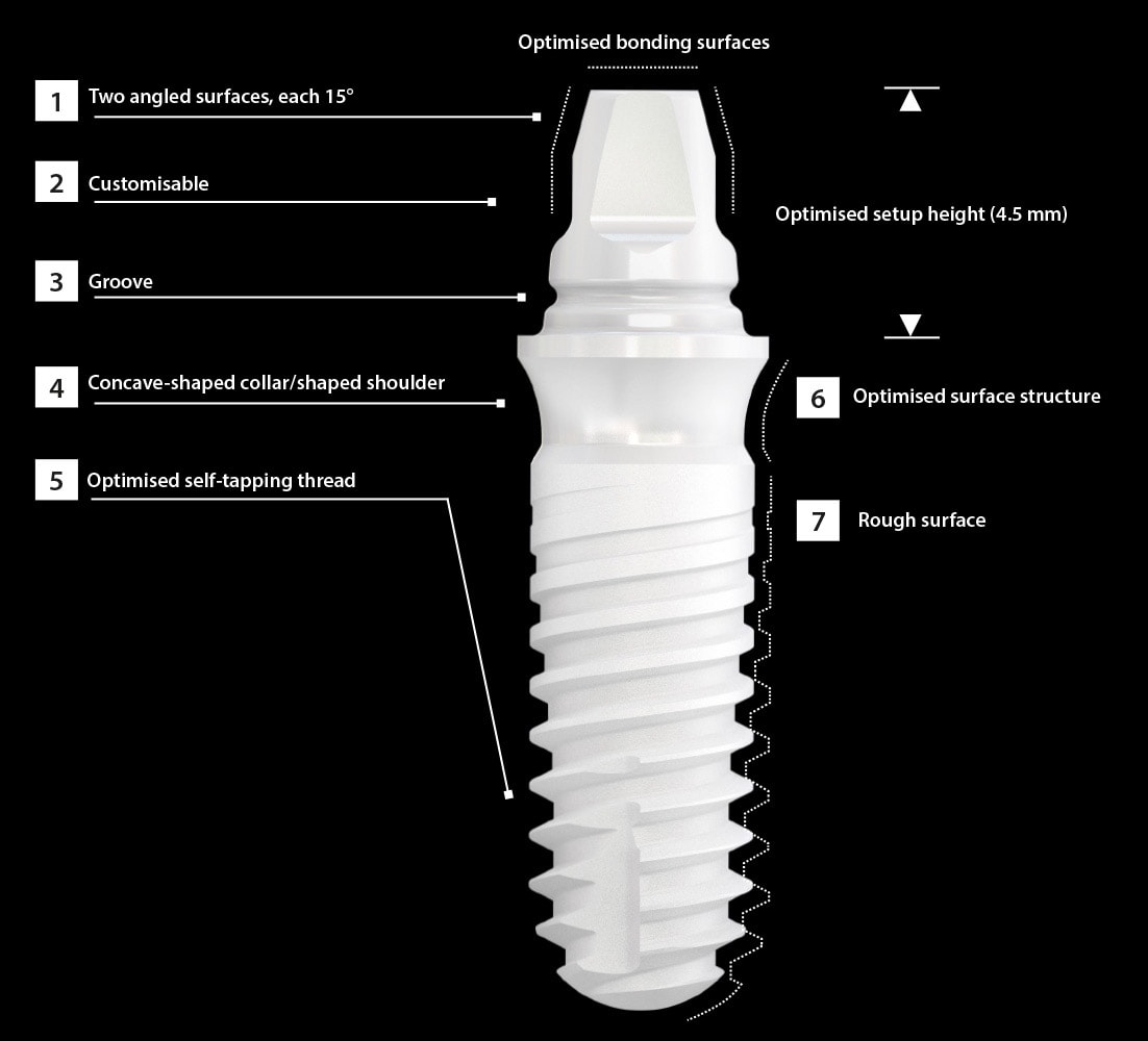 whiteSKY - The metal free implant - bredent-implants
