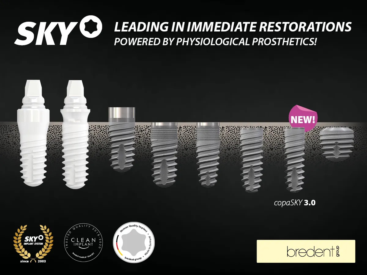SKY Implant system - Leading in immediate restorations